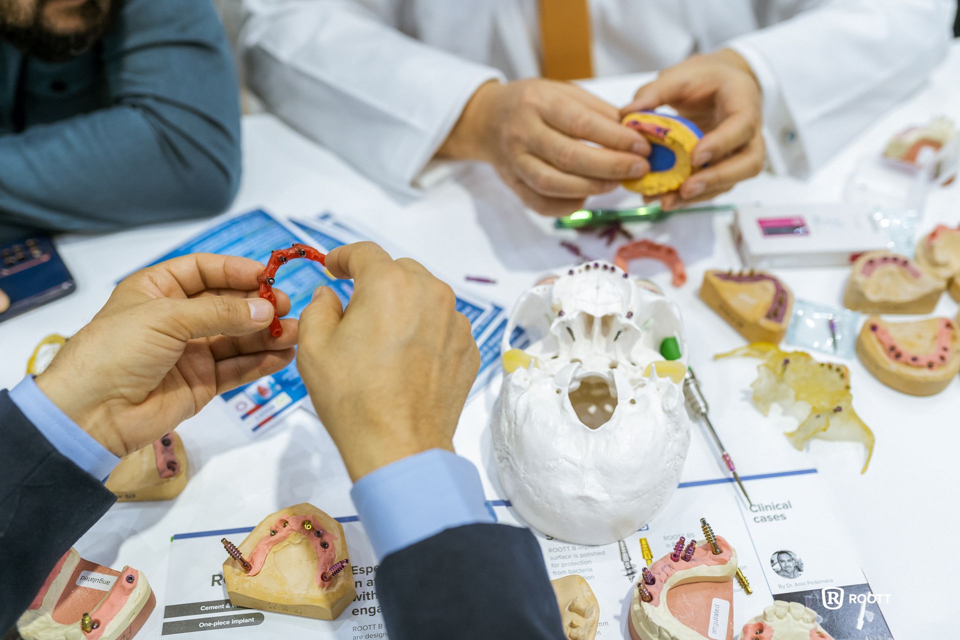 All on ROOTT Solution | Roott implants (UAE)