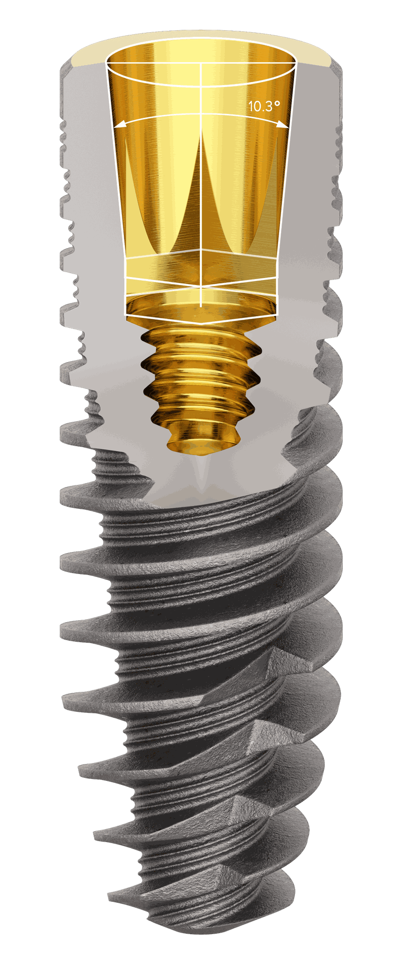 ROOTT Dental Implants | Roott implants (UAE)